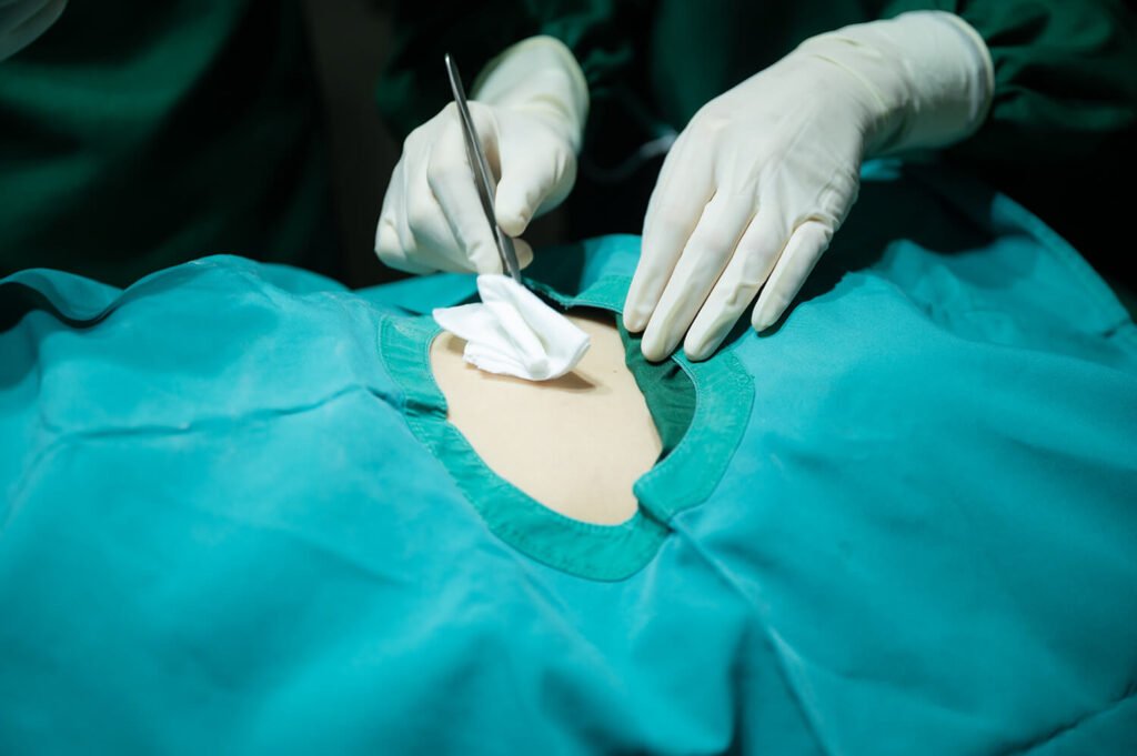 Bariatric Surgery | Weight Loss Solutions
