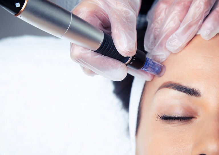 Brazilian Mix | Microneedling & More