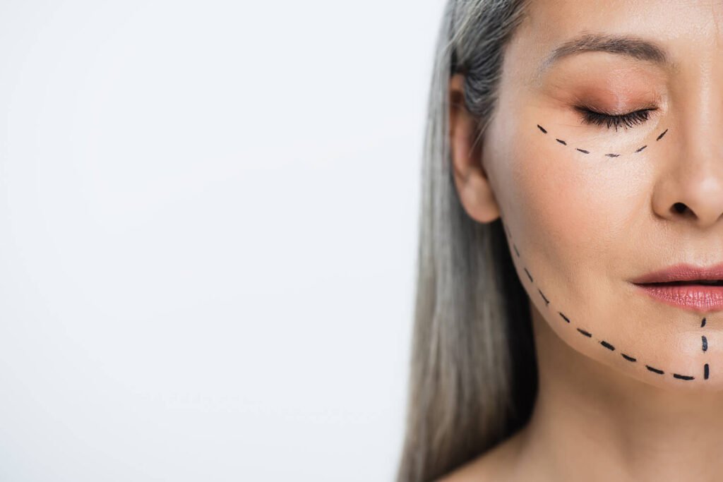 Lift Mix | Non-Surgical Lift